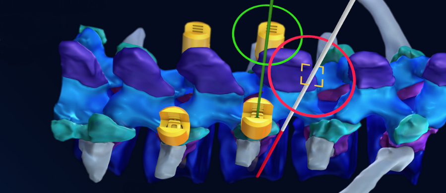 HoloSurgical (1) – OrthoFeed