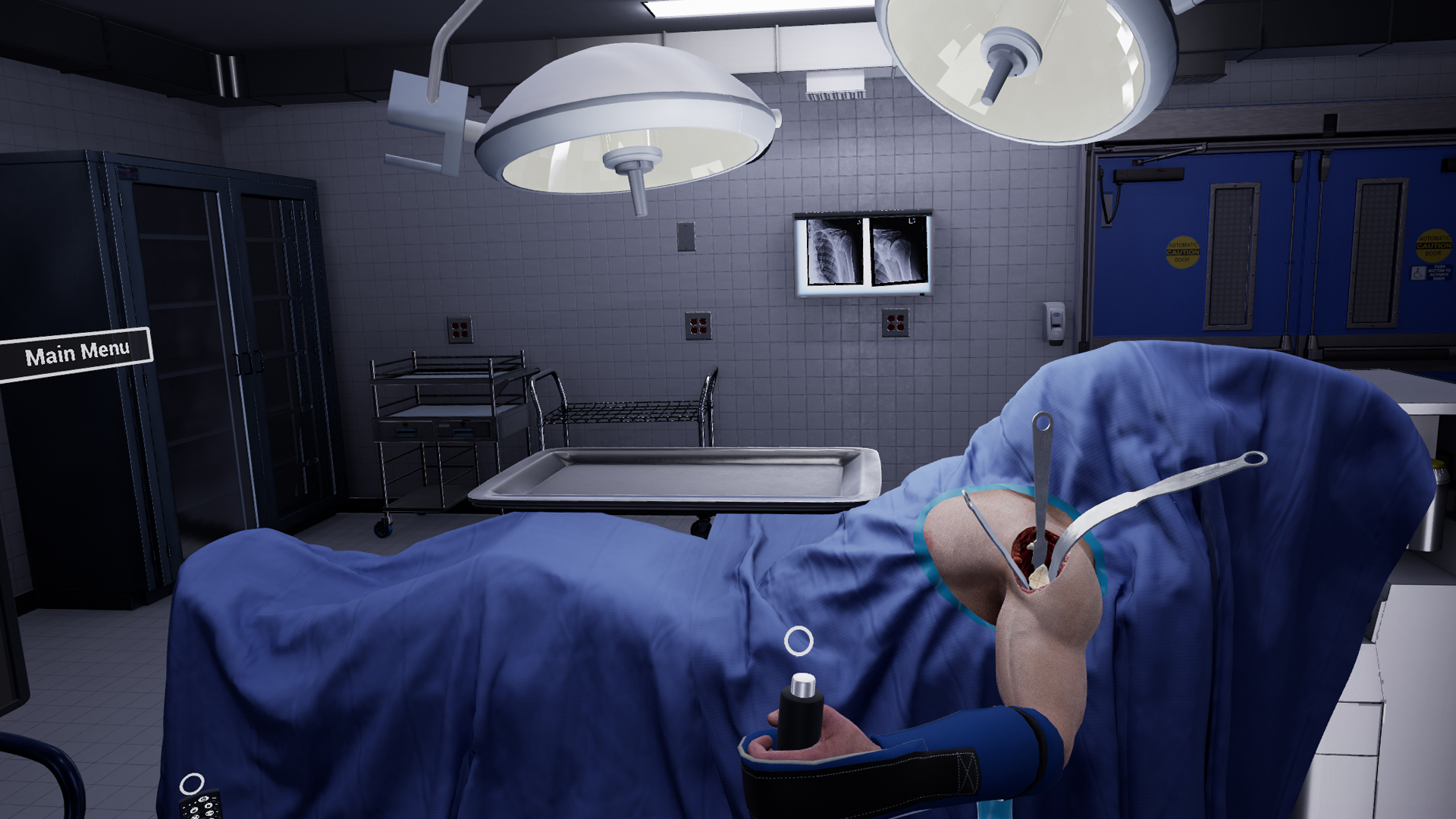 PrecisionScreen04n – OrthoFeed